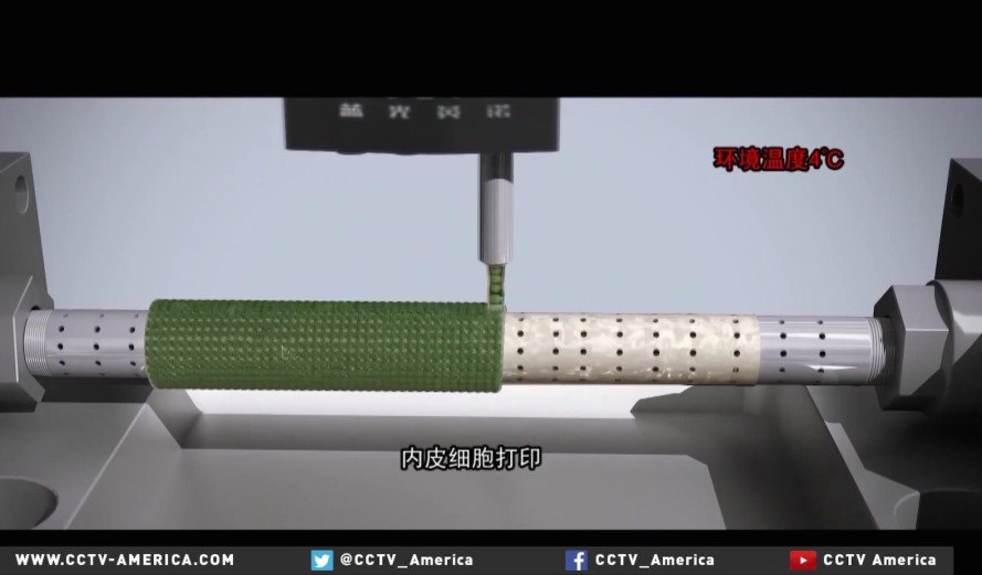 World’s first blood vessel 3D bio printer by Revotek | Inhabitat ...